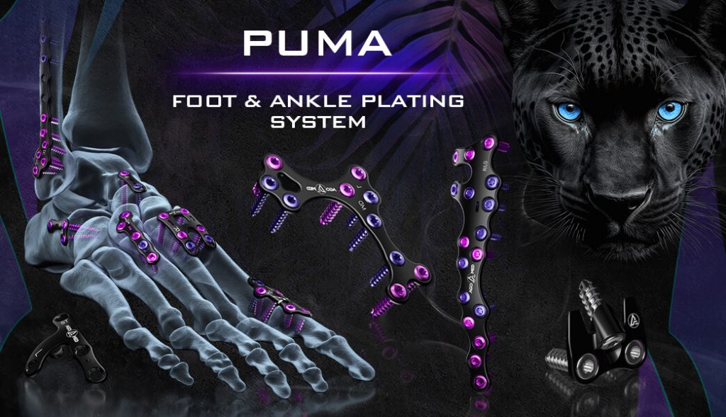 Our New PUMA Foot & Ankle System – Agomed