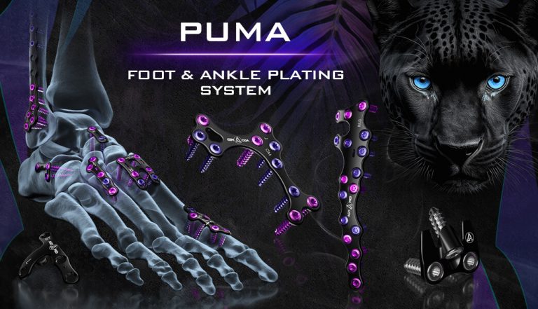Our New PUMA Foot & Ankle System – Agomed